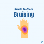 10 Side Effects of Prednisone for Arthritis Patients