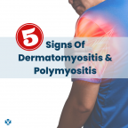 Five Common Signs of Dermatomyositis and Polymyositis