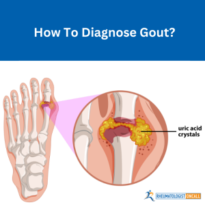 Rheumatologists Guide: How To Diagnose Gout