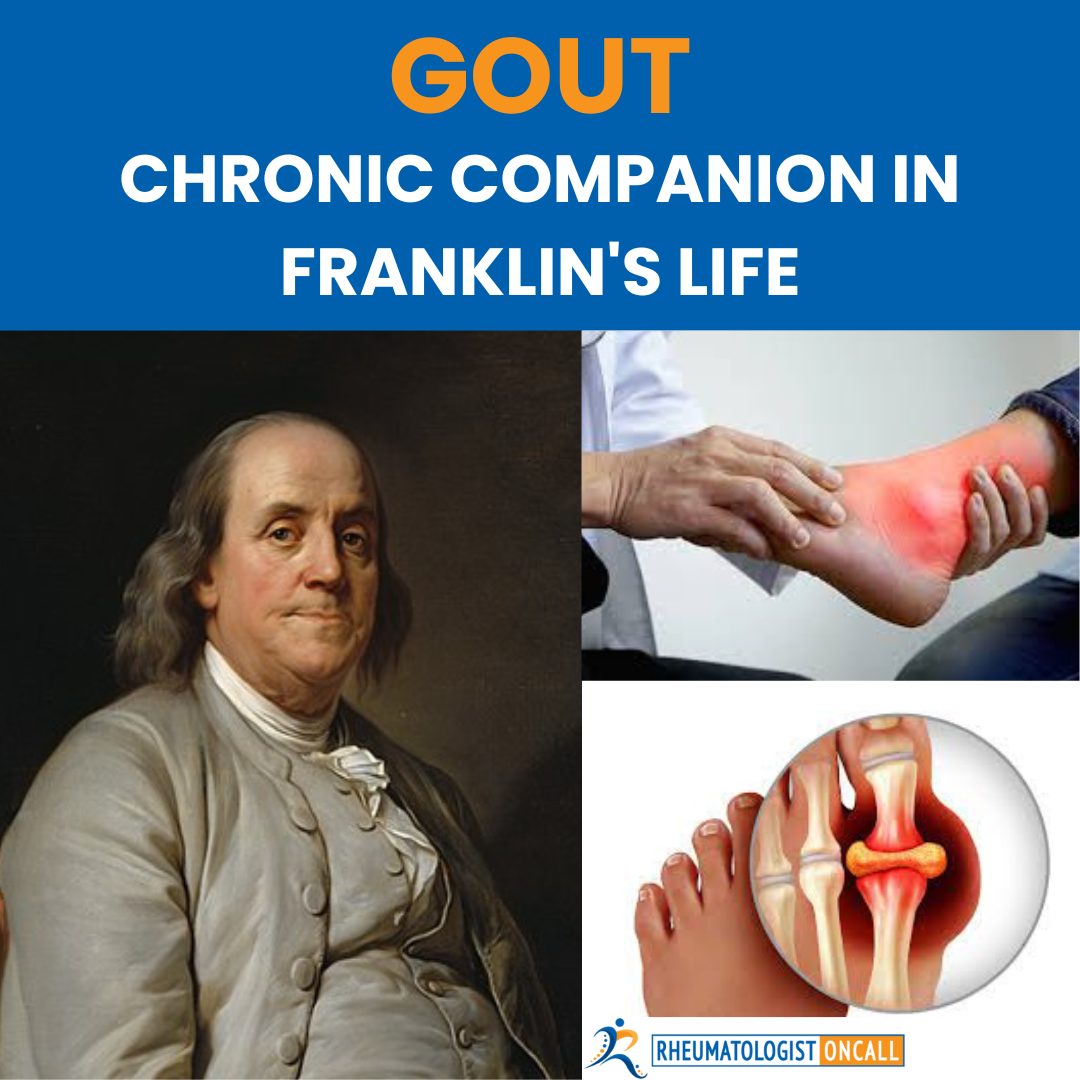 How Five Iconic Personalities Battled Gout and Shaped History
