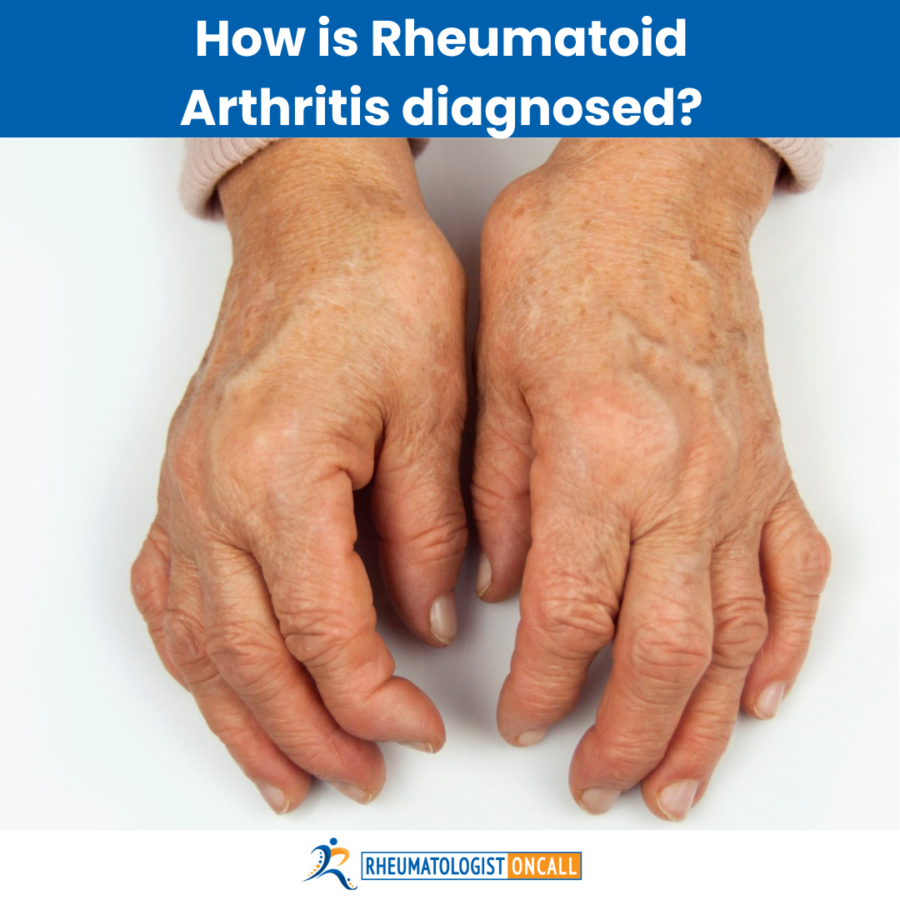 Rheumatoid Arthritis with negative Rheumatoid Factor