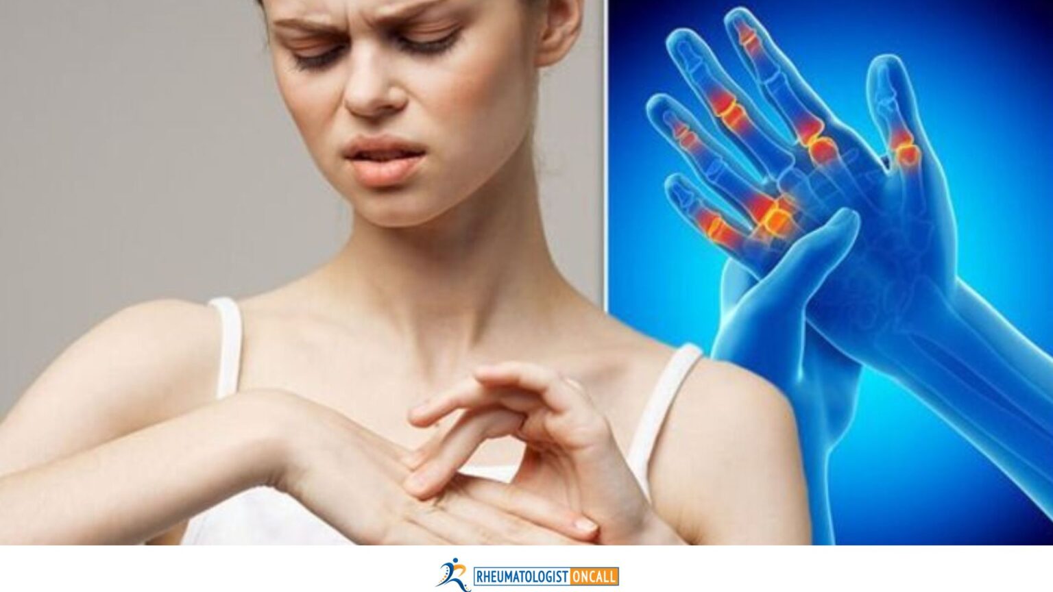 Why Is Rheumatoid Arthritis More Common In Females - Rheumatologist OnCall