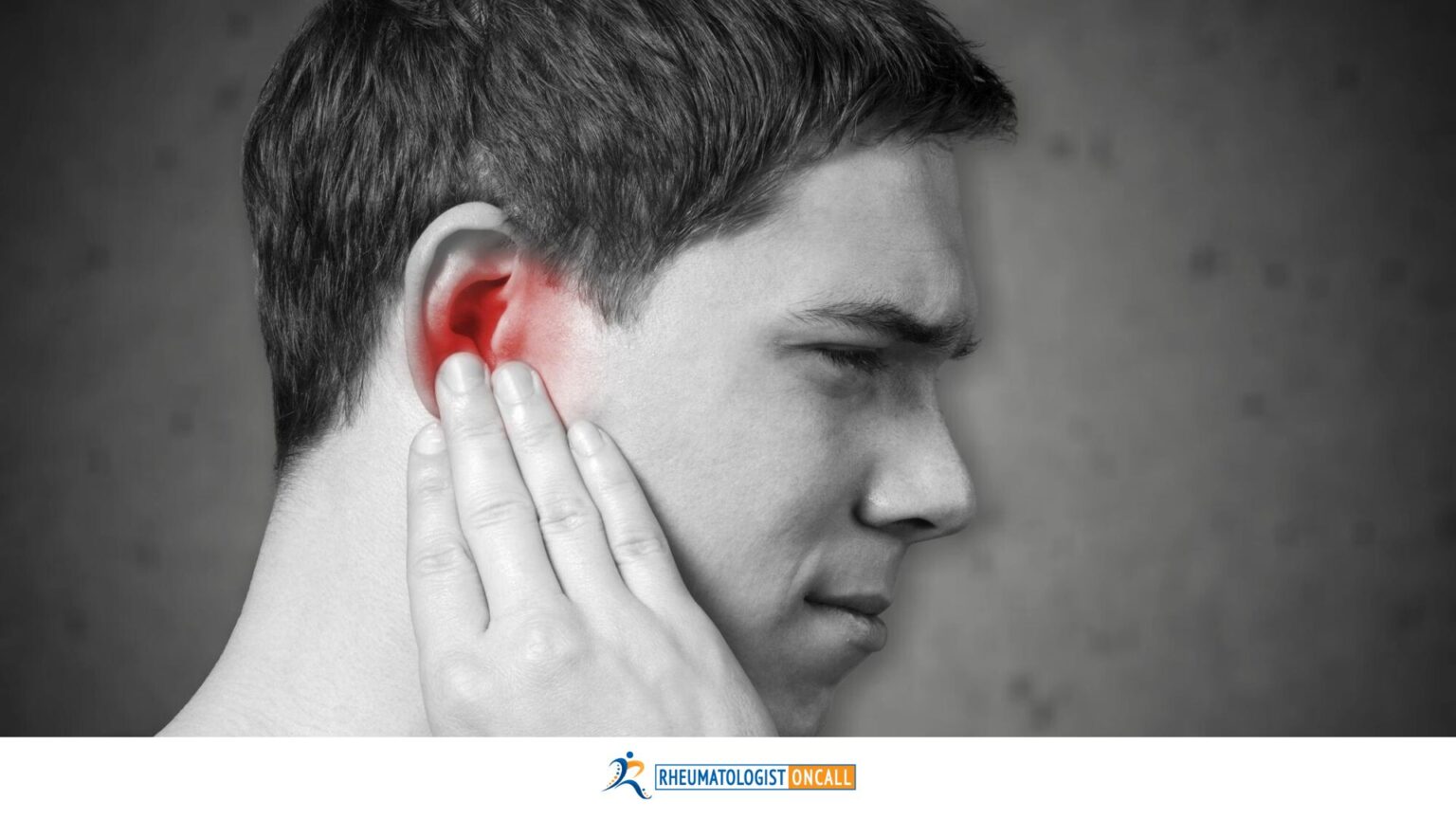 10 Signs of Relapsing Polychondritis » How to Recognize Them ...