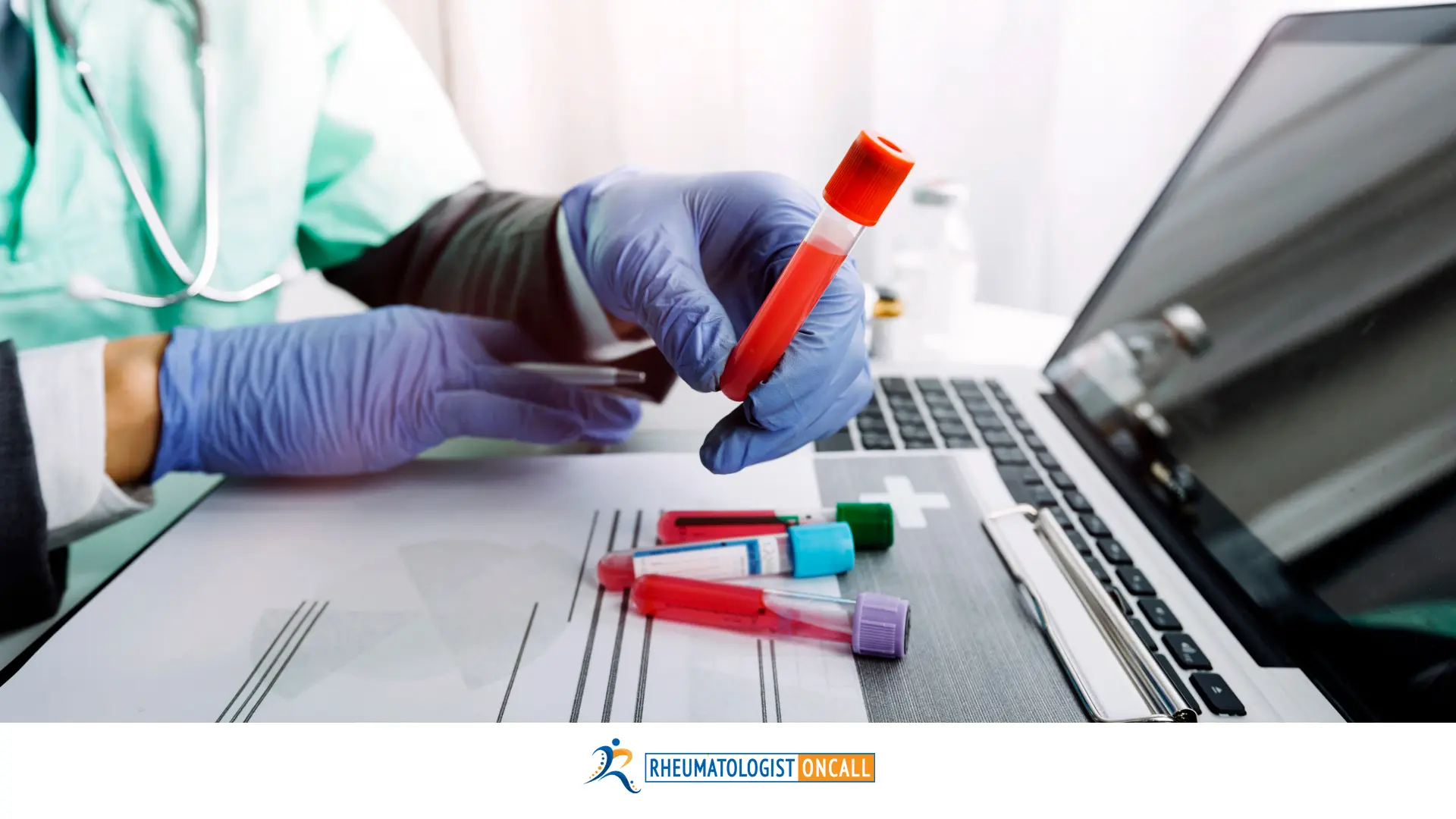 How to Diagnose Sjögren's Syndrome: A Comprehensive Guide ...